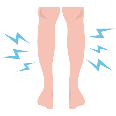 Reaparicion-varices | Sociedad Española de Radiología Vascular e ...