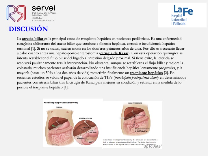 Estenosis bilio-entérica pediátrica | Caso clínico SERVEI